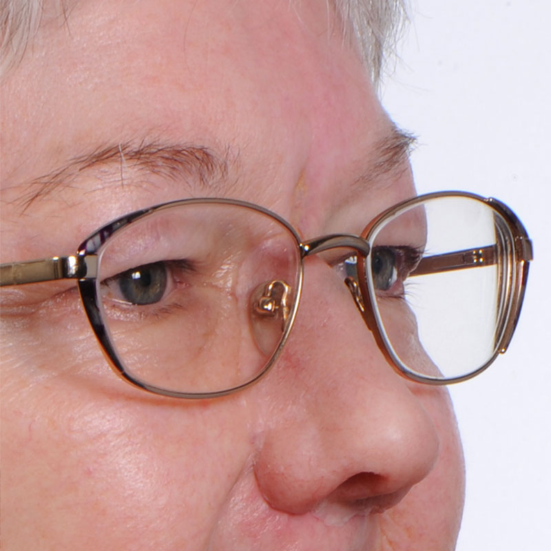 Nasenepithesen – Epithesen Erlangen